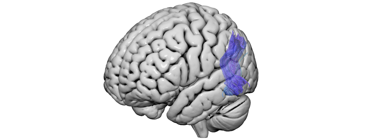 Exploring the neural architecture that scaffolds consciousness ...